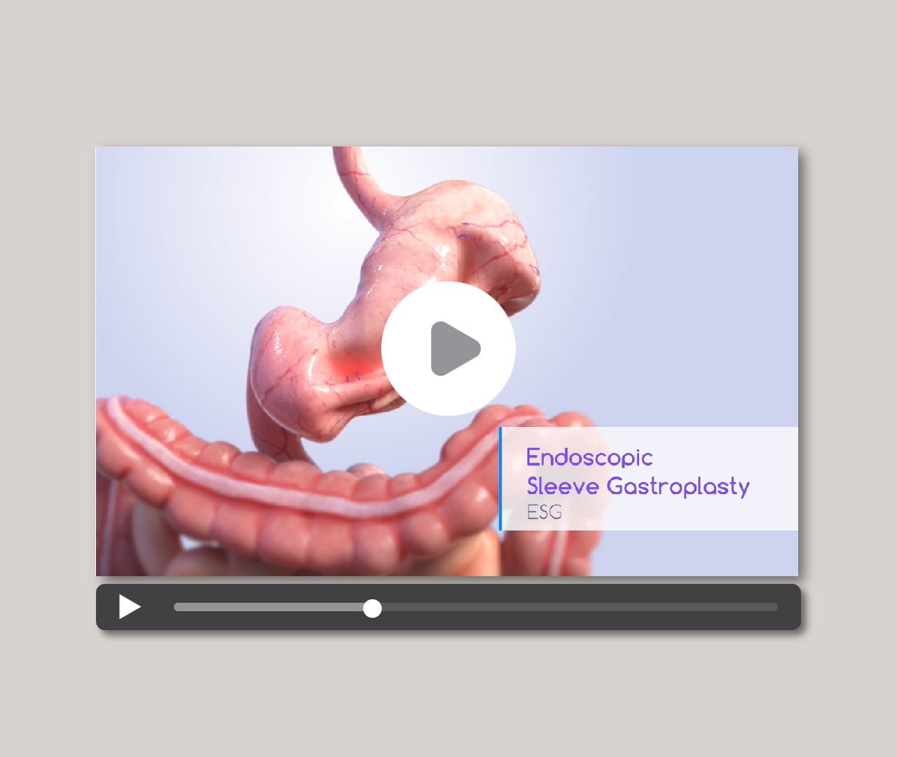 Endoscopic Procedures - YUSIN Biomedical Visualization